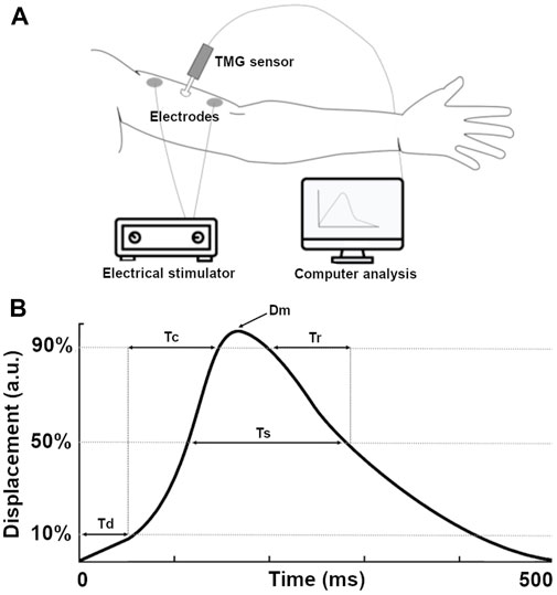 Frontiers | Tensiomyography: from muscle assessment to talent ...