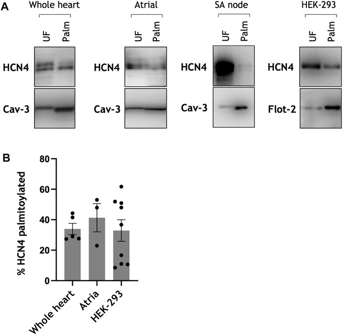 Frontiers | Palmitoylation regulates the magnitude of HCN4-mediated ...