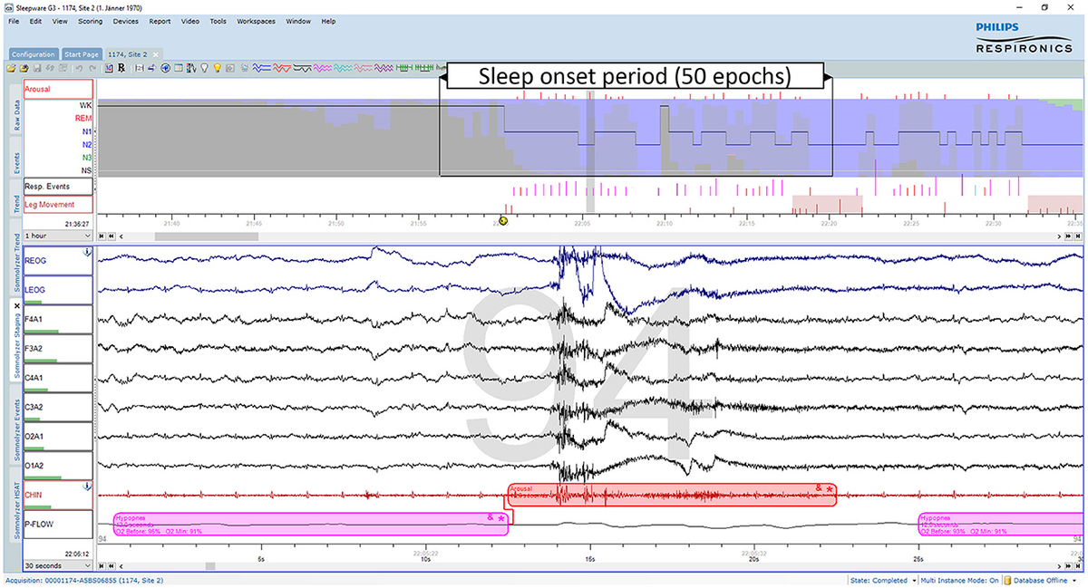 Frontiers | Overview of the hypnodensity approach to scoring sleep for polysomnography and home ...