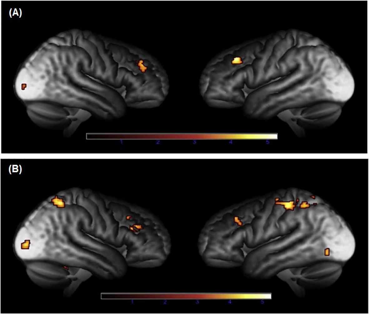 Frontiers | Functional brain alterations in Cushing’s syndrome