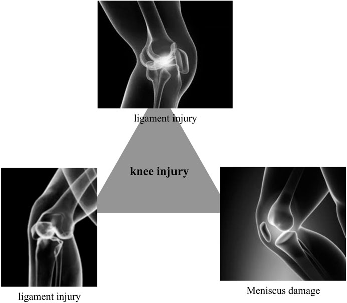 Frontiers | Value evaluation of knee joint sports injury detection ...