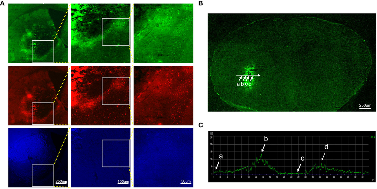 Frontiers | Blocking autofluorescence in brain tissues affected by ...
