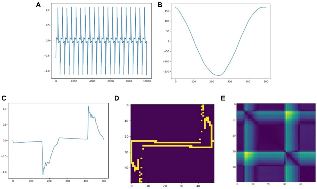 Frontiers | A Wasserstein-based distributionally robust neural network for non-intrusive load ...