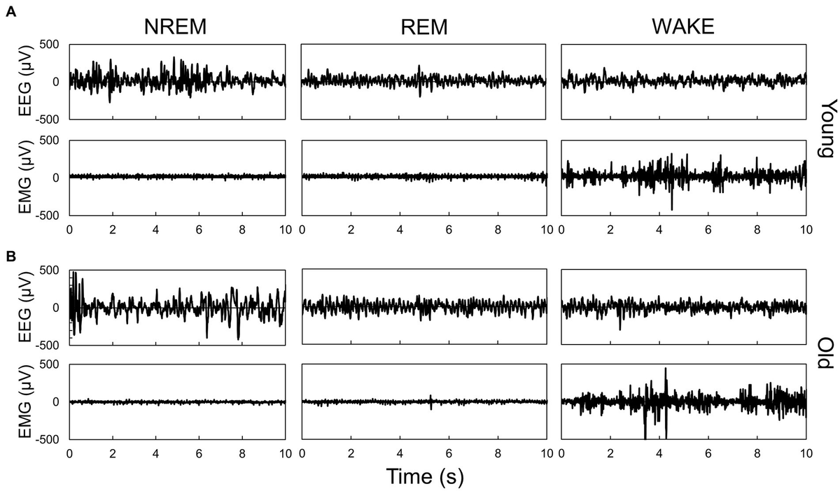 Frontiers | Analysis of circadian rhythm components in EEG/EMG data of ...