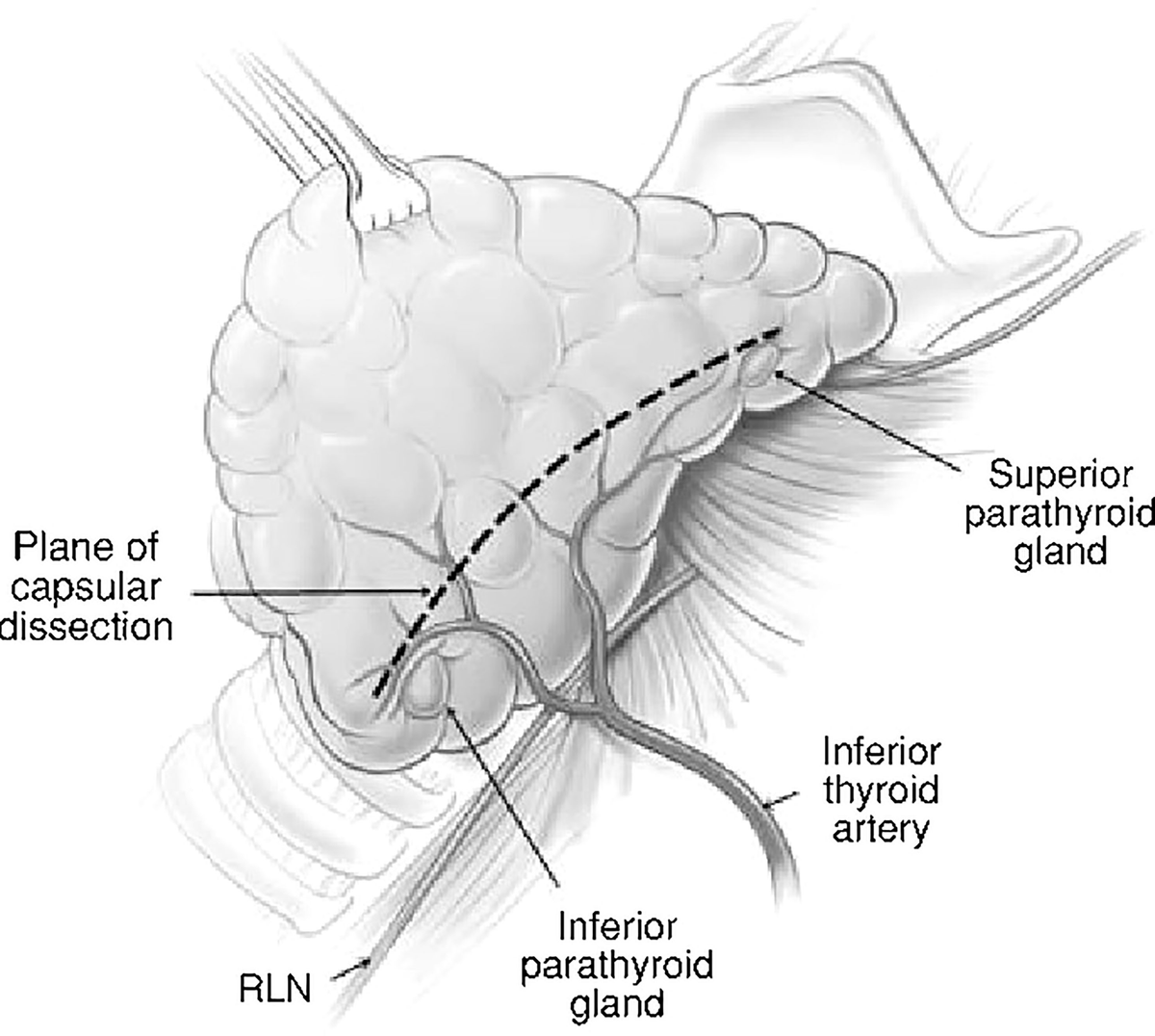 Frontiers | Preservation of parathyroid glands during thyroid and neck ...