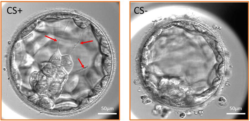 Frontiers | The importance of cytoplasmic strings during early human ...