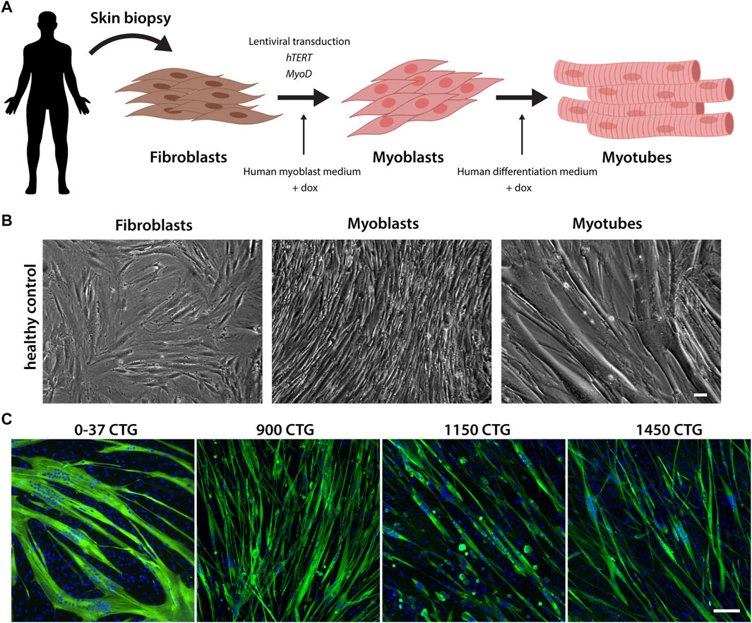 Frontiers | Promising AAV.U7snRNAs vectors targeting DMPK improve DM1 ...