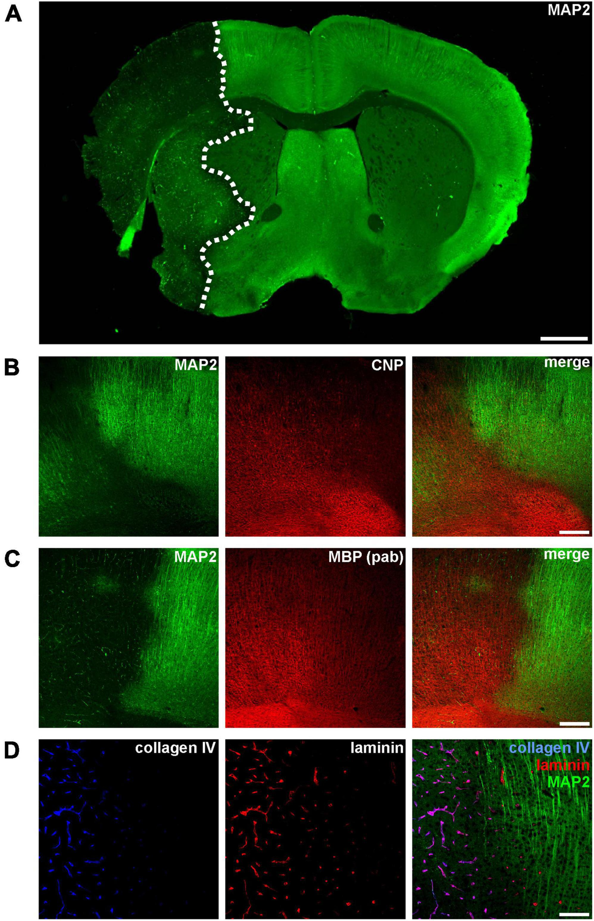 Frontiers | Increasing reproducibility in preclinical stroke research ...