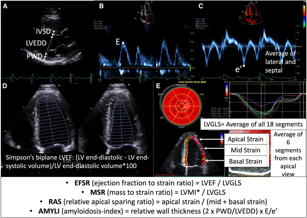Frontiers | Cardiac “hypertrophy” phenotyping: differentiating ...