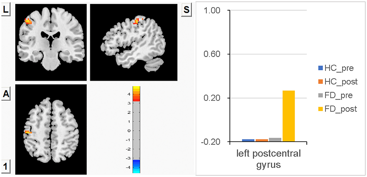 Frontiers | Differential responses from the left postcentral gyrus ...