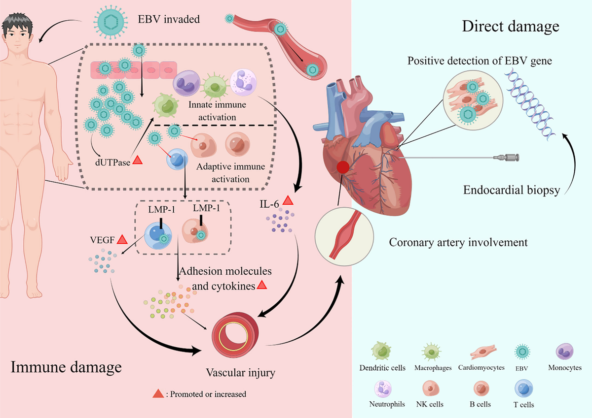 Frontiers | Cardiovascular involvement in Epstein–Barr virus infection