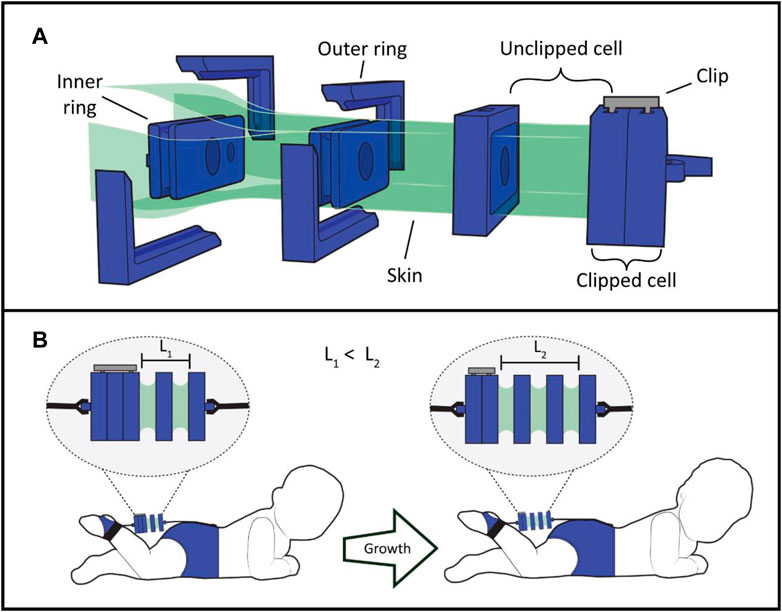Frontiers | A length-adjustable vacuum-powered artificial muscle for ...