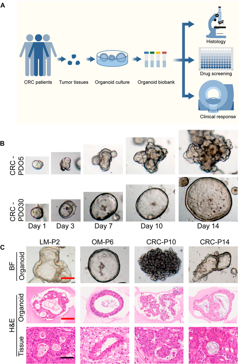 Frontiers | Patient-derived organoids as a platform for drug screening ...