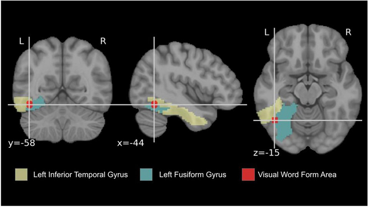 Frontiers | Beyond the Visual Word Form Area – a cognitive ...