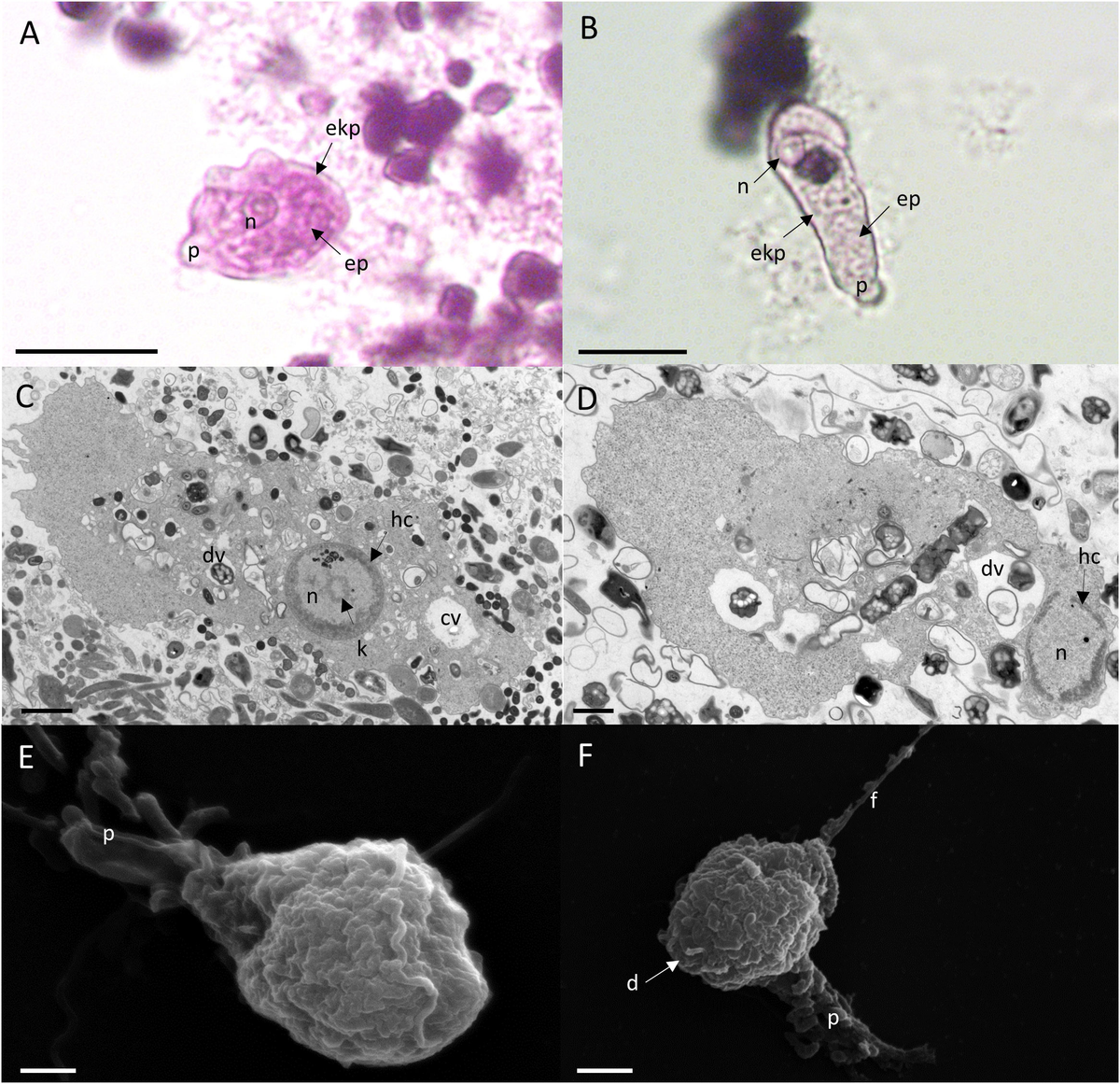 Frontiers | In vitro induction of Entamoeba gingivalis cyst-like ...