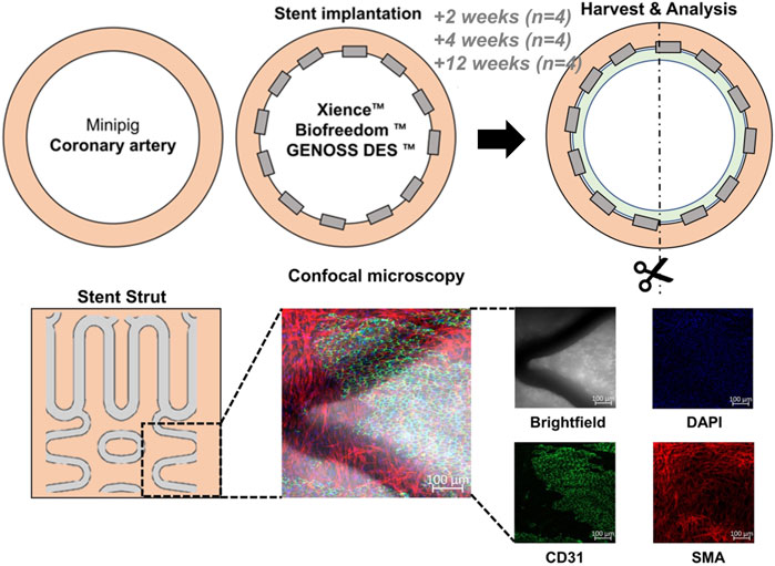 Frontiers | Faster smooth muscle cell coverage in ultrathin-strut drug ...