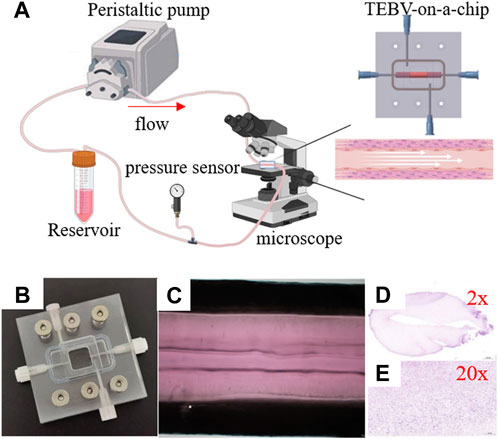 Frontiers | A new approach of using organ-on-a-chip and fluid–structure interaction modeling to ...