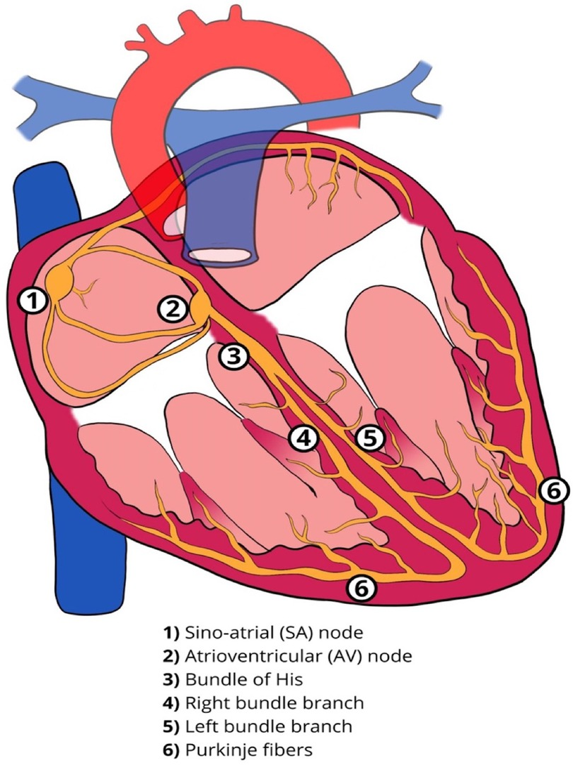Frontiers | Conduction system pacing on track to replace CRT? Review of ...