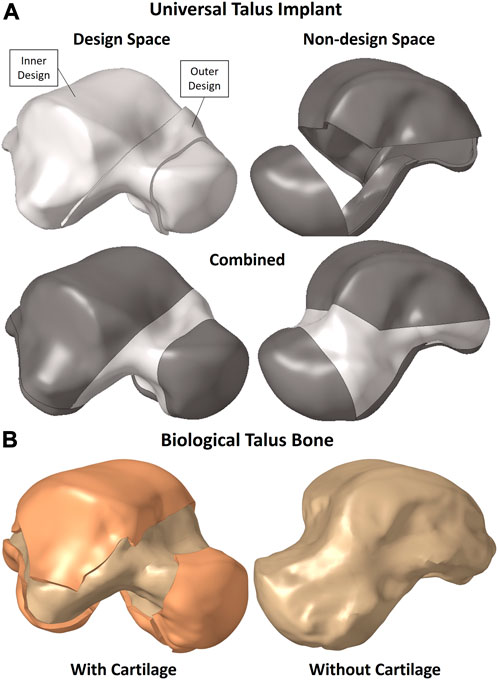Frontiers | Design of a lightweight universal talus implant using ...