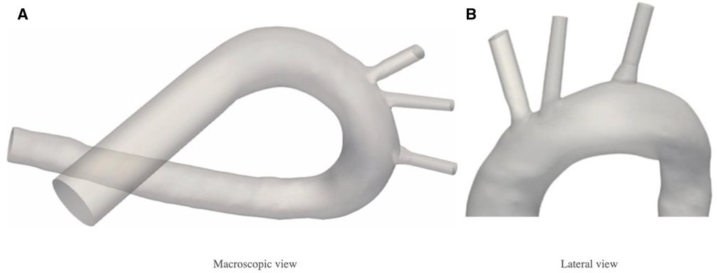 Frontiers | Performance assessment of an electrostatic filter-diverter ...