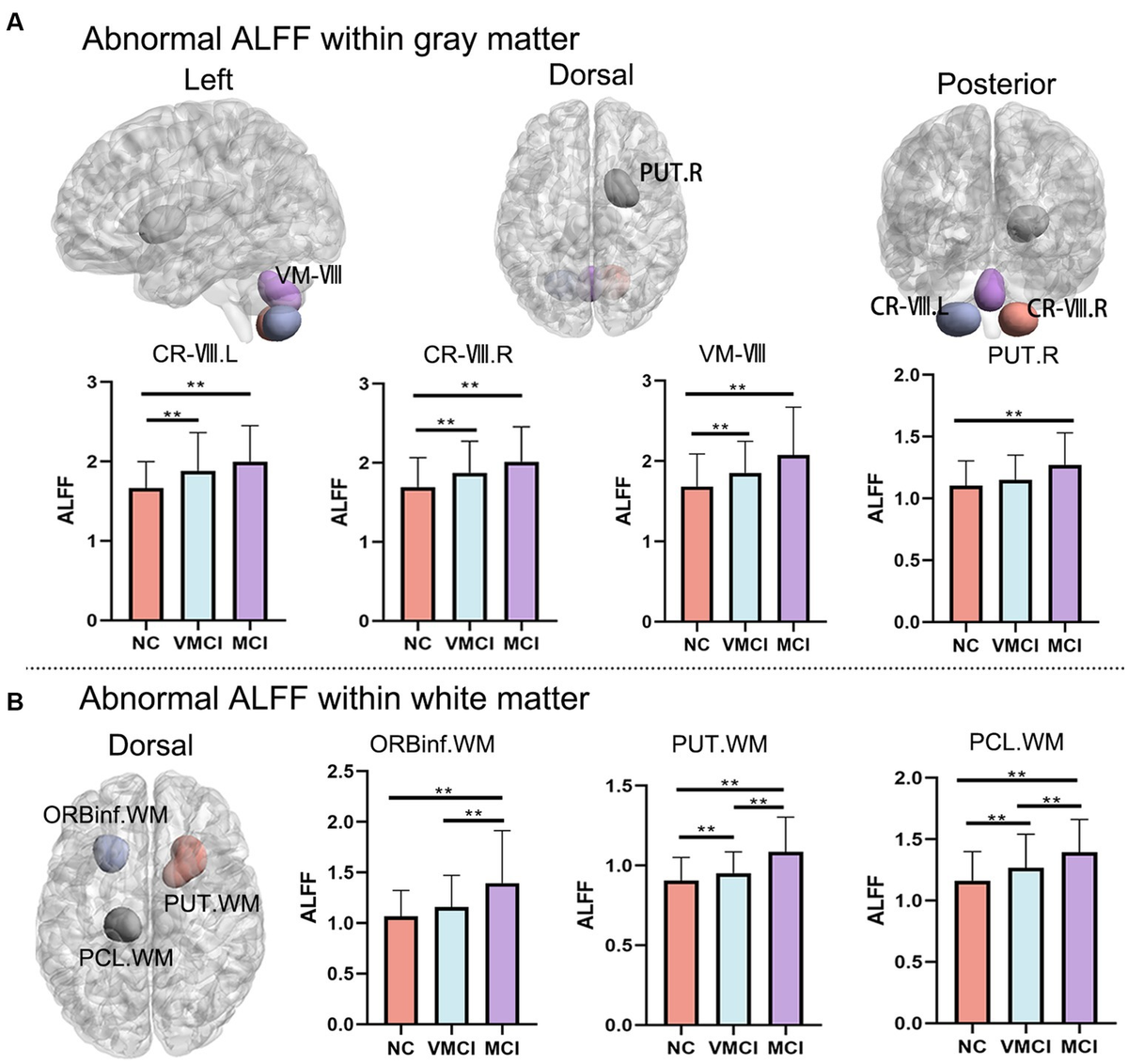 Frontiers | Whole-brain structure–function coupling abnormalities in ...