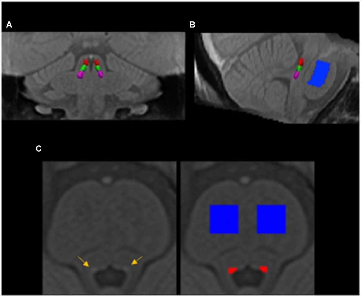 Frontiers | Interactive effects of locus coeruleus structure and ...