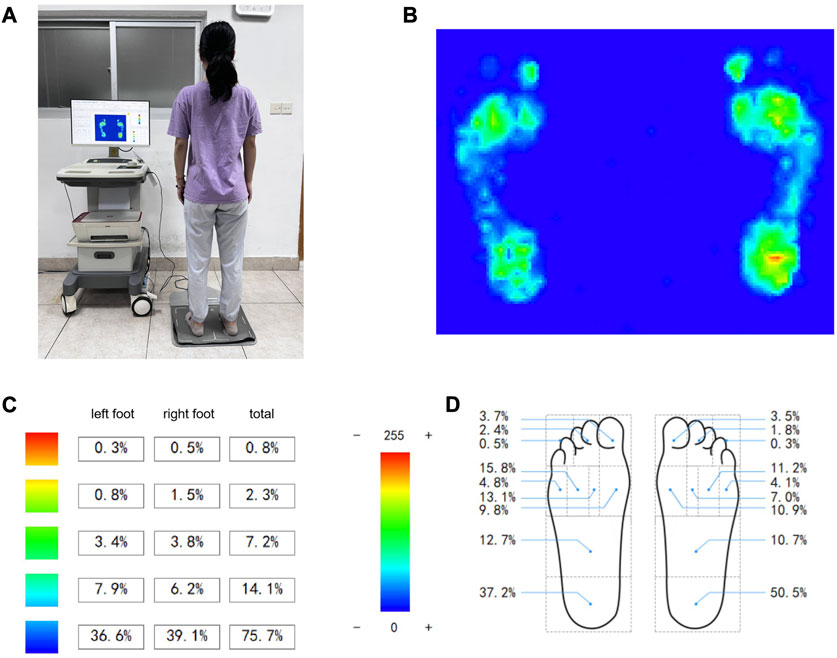 Frontiers | A deep learning method for foot-type classification using ...
