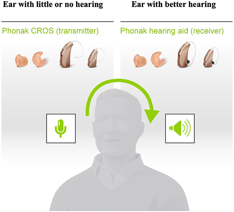Frontiers | Device-based interventions that seek to restore bilateral ...