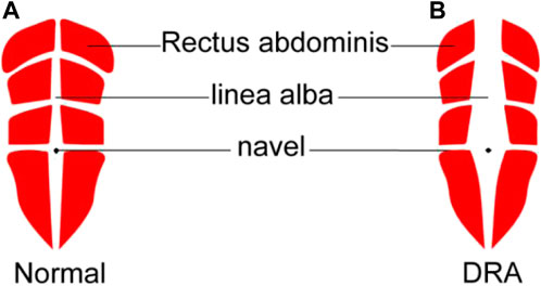 Frontiers | A deep learning-based approach for rectus abdominis ...