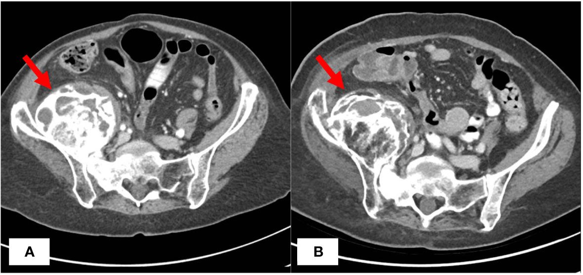 Frontiers Case Report Prolonged Durable Clinical Benefit And Low