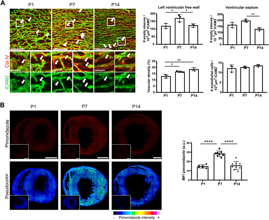 Frontiers | Capillary pruning couples tissue perfusion and oxygenation ...