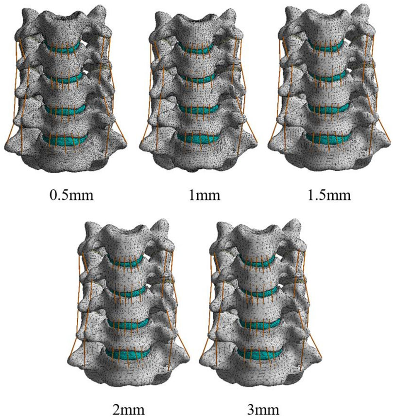 Frontiers | Biomechanical evaluation of a novel anterior transpedicular ...