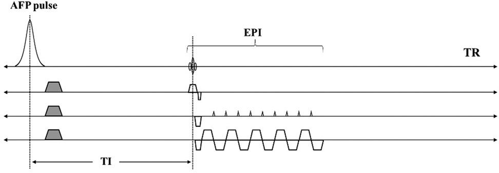 Frontiers | Quantitative myelin water imaging using short TR adiabatic ...