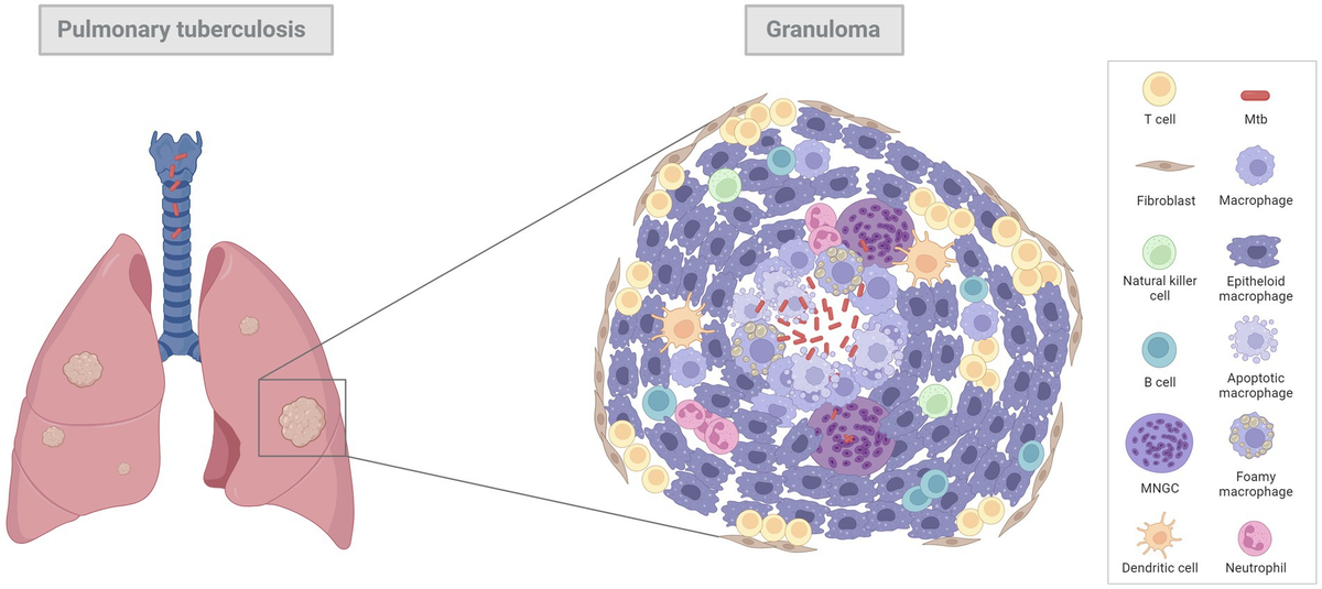 Frontiers | Comparative pathology of experimental pulmonary ...