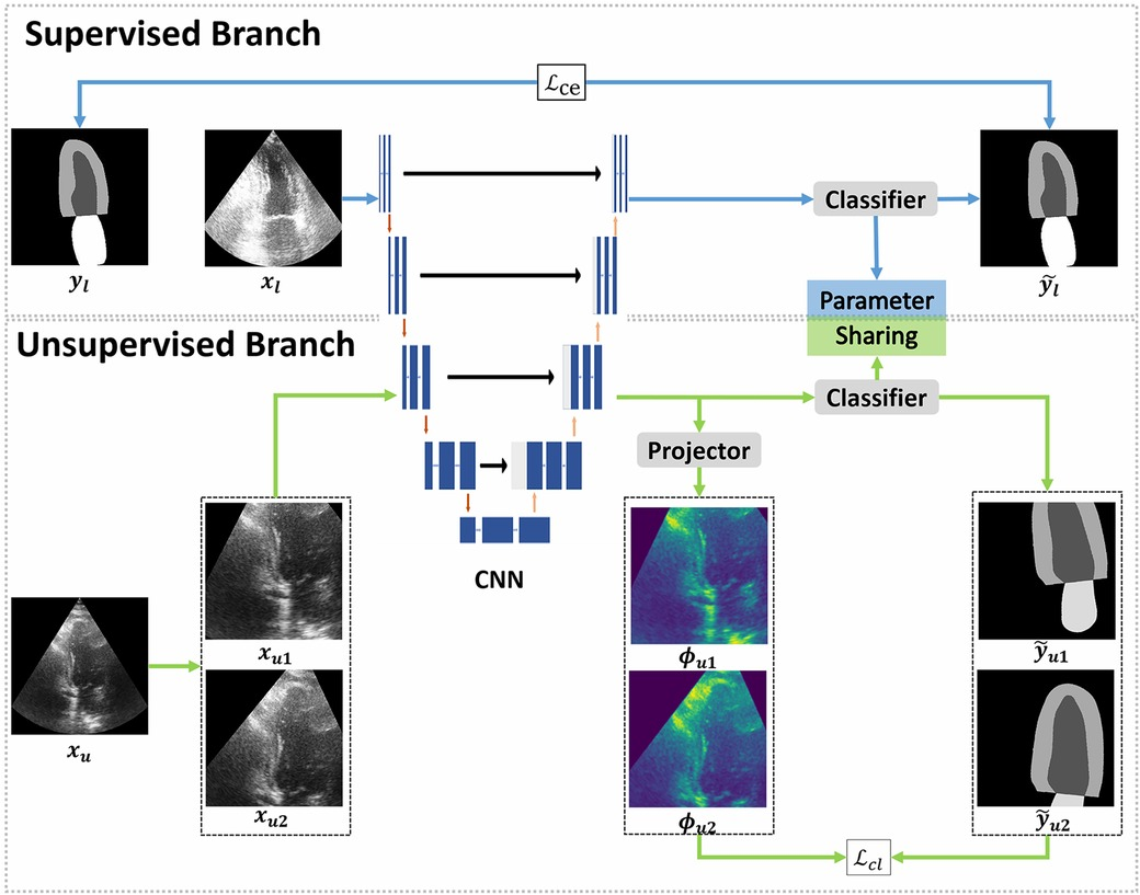 Frontiers | An improved contrastive learning network for semi-supervised multi-structure ...