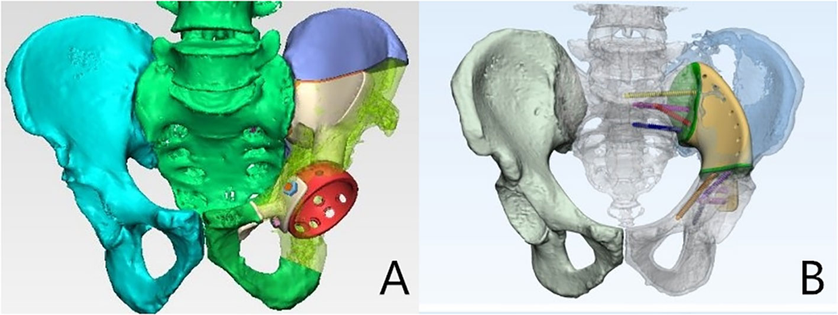 Frontiers | Clinical exploration of the international society of limb ...