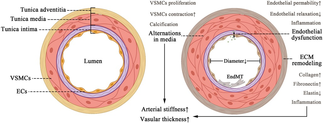 Frontiers | An emerging view on vascular fibrosis molecular mediators ...