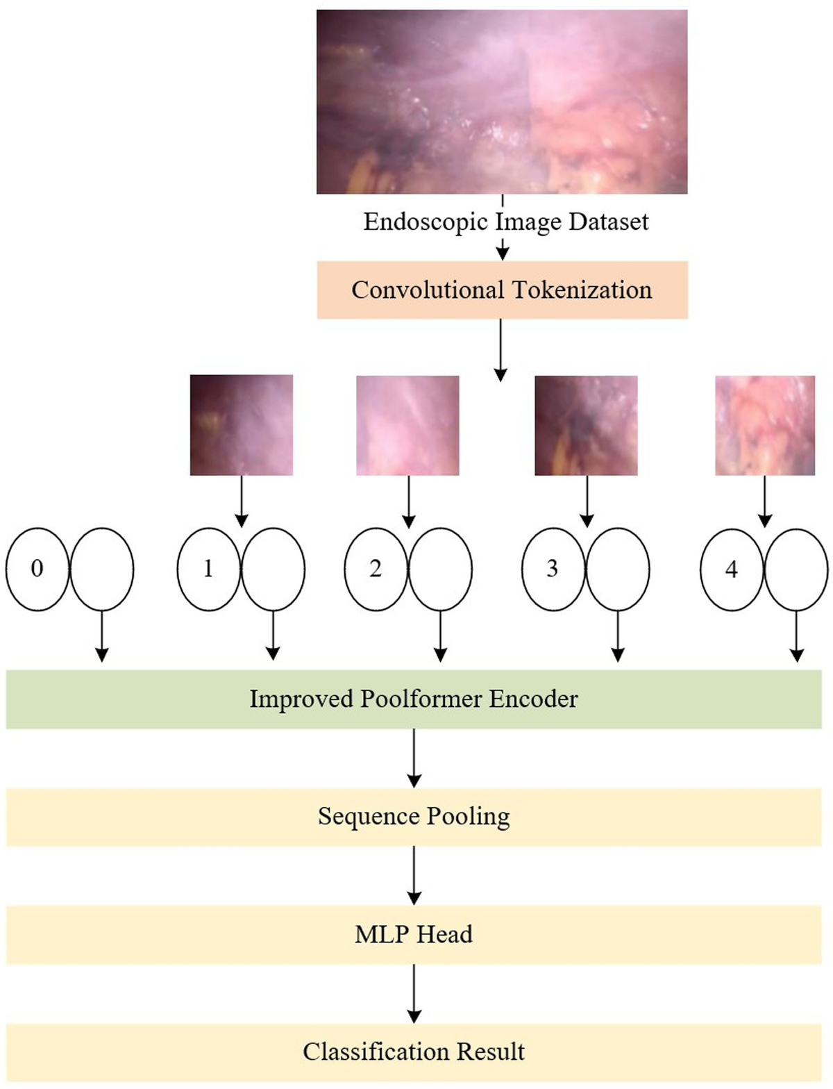 Frontiers | Endoscopic image classification algorithm based on Poolformer