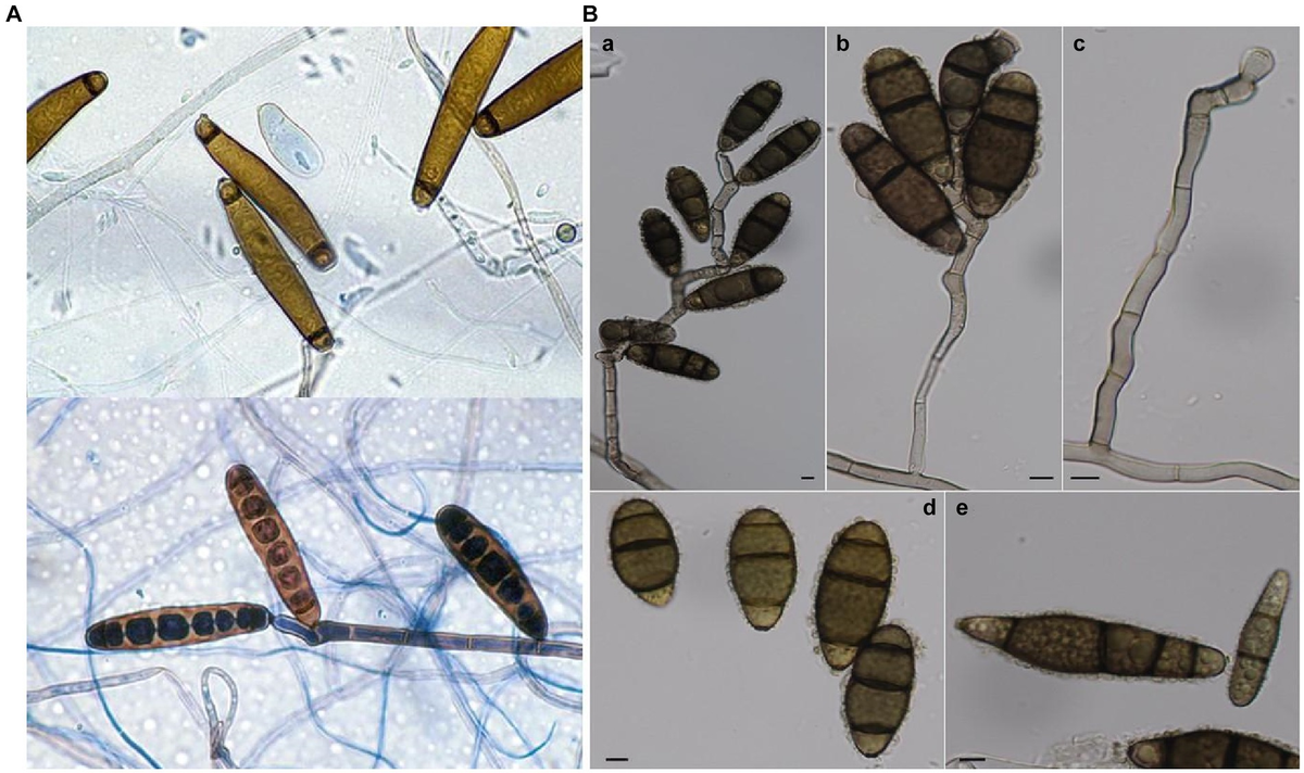 Frontiers | Unveiling Curvularia tuberculata-induced leaf anomalies in ...