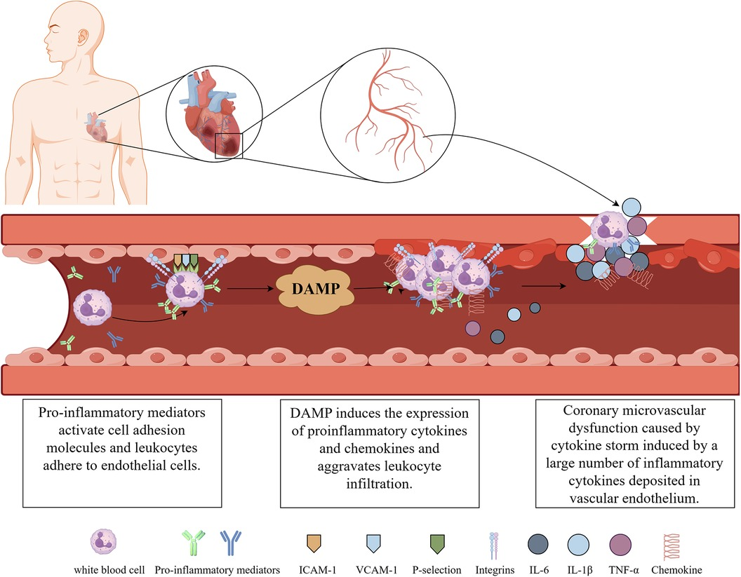 Frontiers | Inflammation and coronary microvascular disease ...