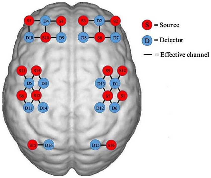 Frontiers | Cortical activity associated with focal muscle vibration ...