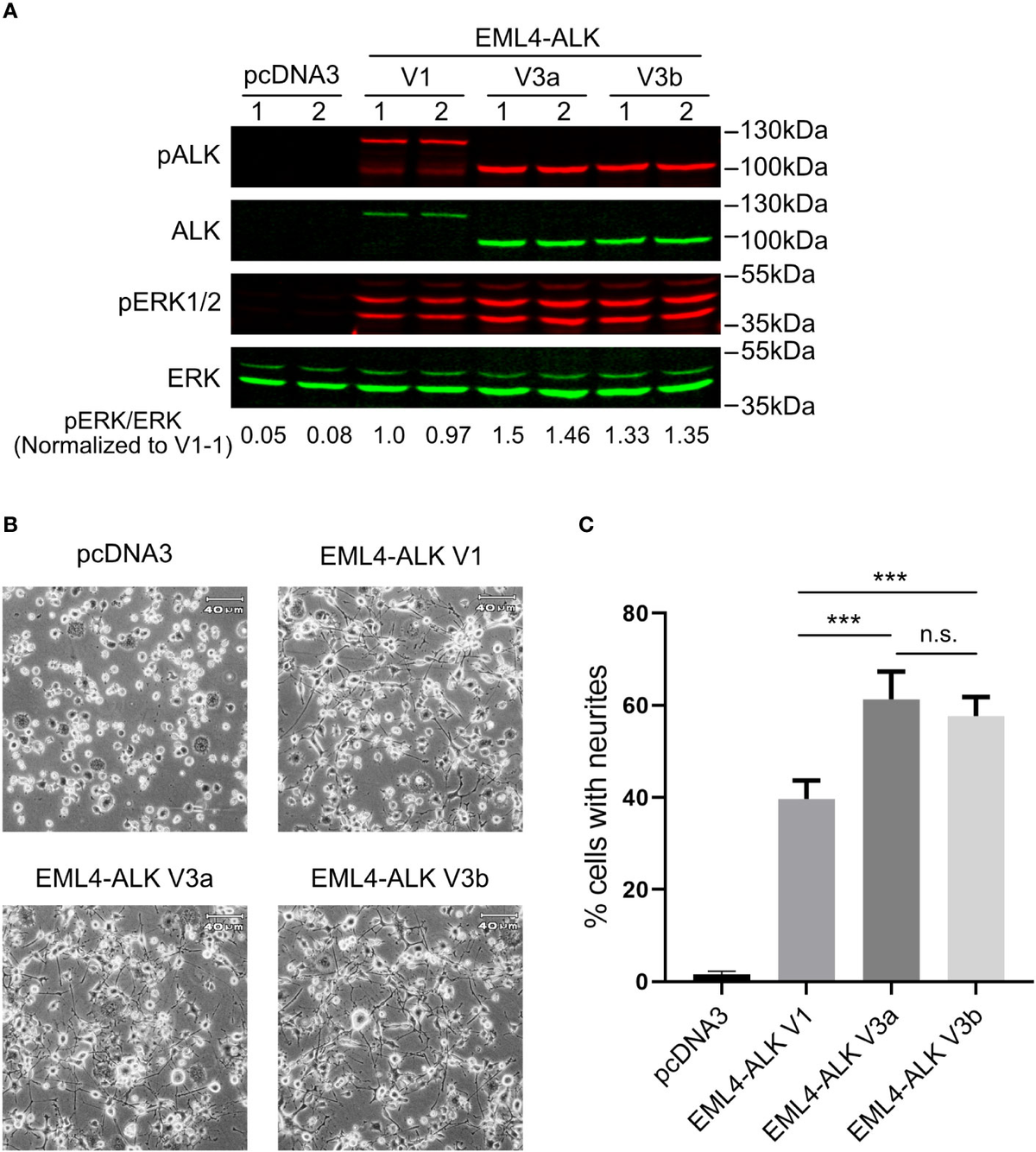 Frontiers | ALK F1174S mutation impairs ALK kinase activity in EML4-ALK ...