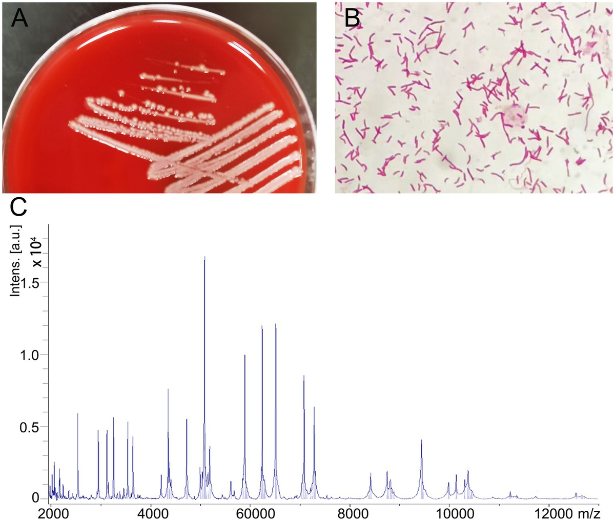 Frontiers | Bacteremia caused by Comamonas kerstersii in a patient with ...