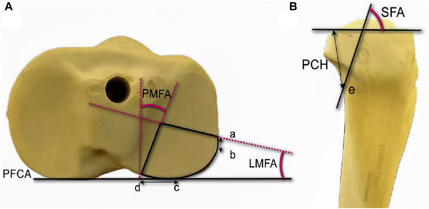 Frontiers | Biomechanics and finite element analysis comparing ...