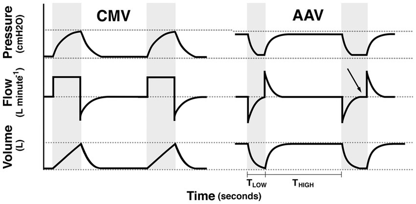 Frontiers | Apneustic anesthesia ventilation improves pulmonary ...