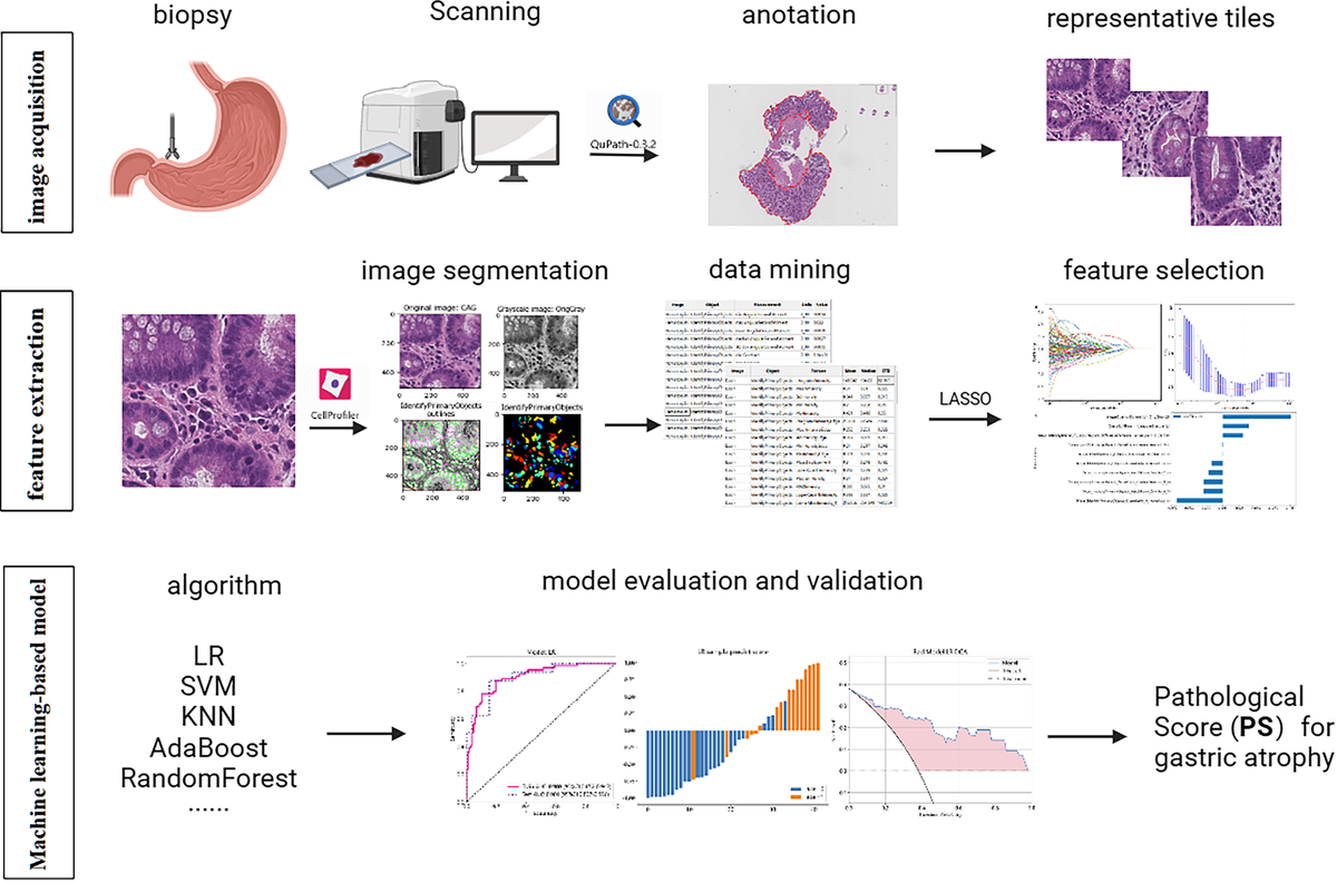 Frontiers | Clinical application of machine learning‐based pathomics signature of gastric atrophy