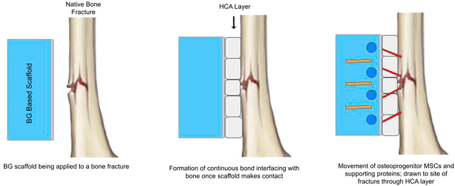 Frontiers | Ion—modified optimization of smart scaffolds in bone tissue ...