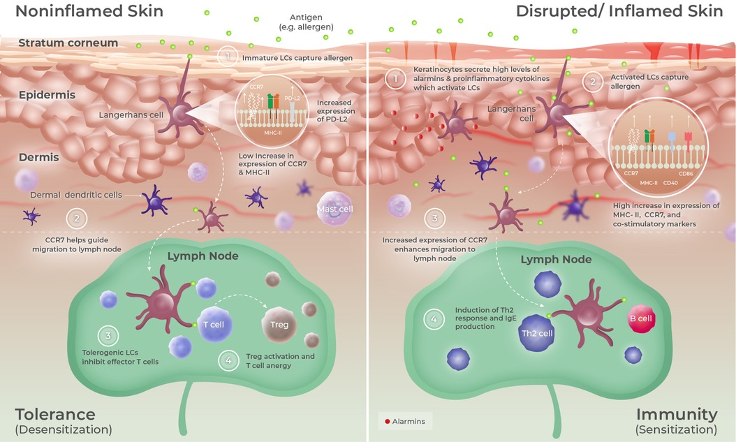 Frontiers | Recent advances in epicutaneous immunotherapy and potential ...