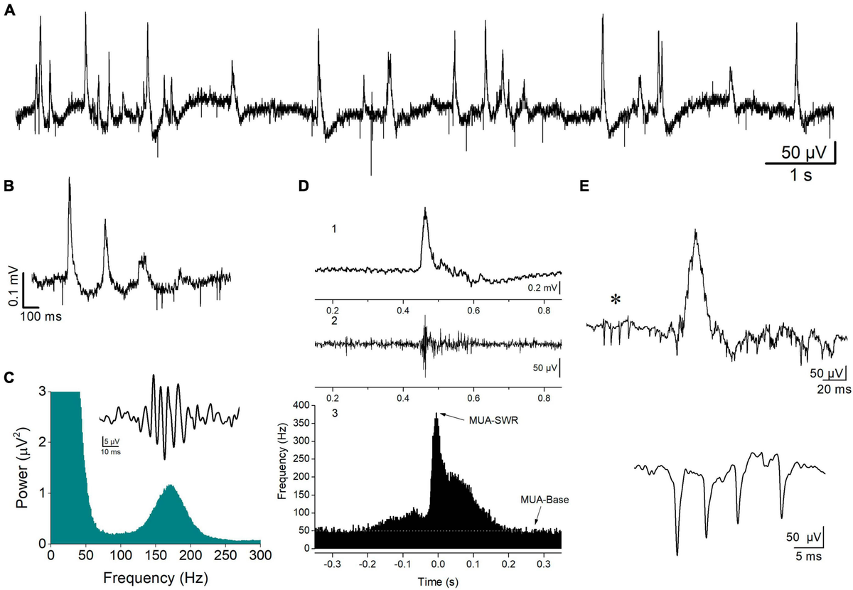 Frontiers | Rescue of sharp wave-ripples and prevention of network ...