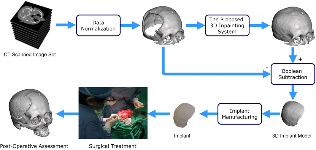 Frontiers | Creating high-resolution 3D cranial implant geometry using deep learning techniques